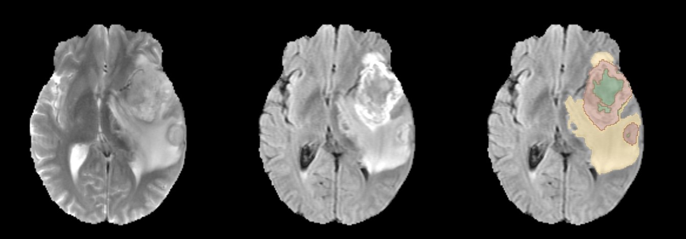 Software – Surgical Planning and Robotic Cognition